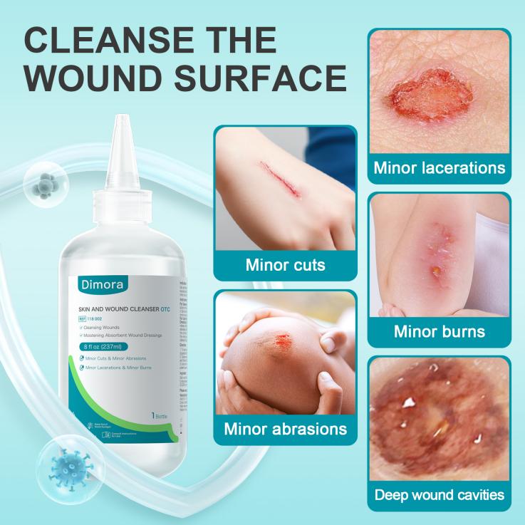Dimora PHMB Skin and Wound Cleanser: The Safe, Professional-Grade Solution for Everyday and ...